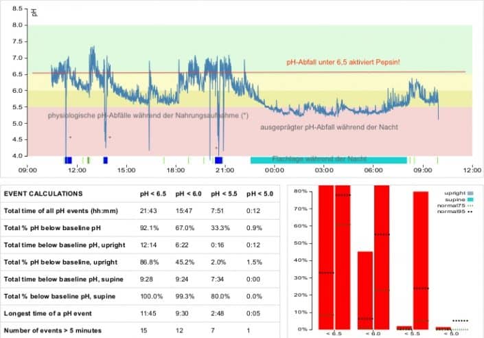 pHmetrie bei stillem Reflux - HNO Praxis Dr. Weinzierl Nürnberg