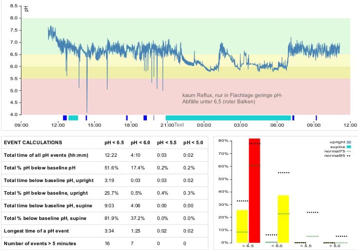 pHmetrie bei stillem Reflux - HNO Praxis Dr. Weinzierl Nürnberg
